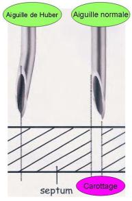 Bonnes Pratiques d'utilisation d'une Chambre à Cathéter Implantable (CCI) - L'injection sur CCI