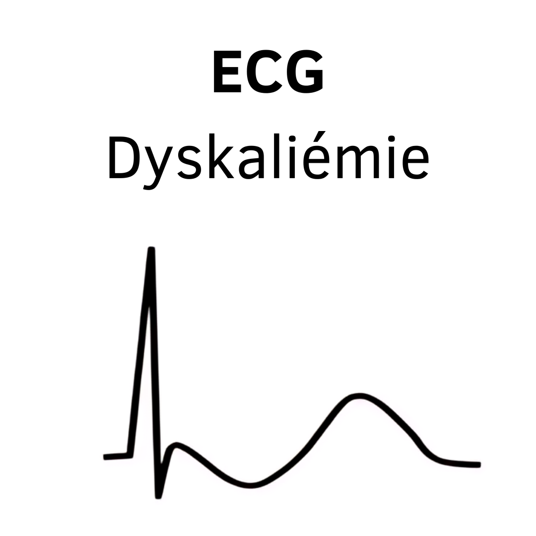 Rappels [Prévenir les erreurs médicamenteuses liées aux injections de ...