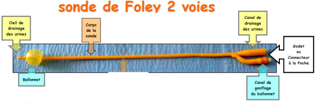 Sondes 2 voies [Bon usage des sondes urinaires et des étuis péniens]